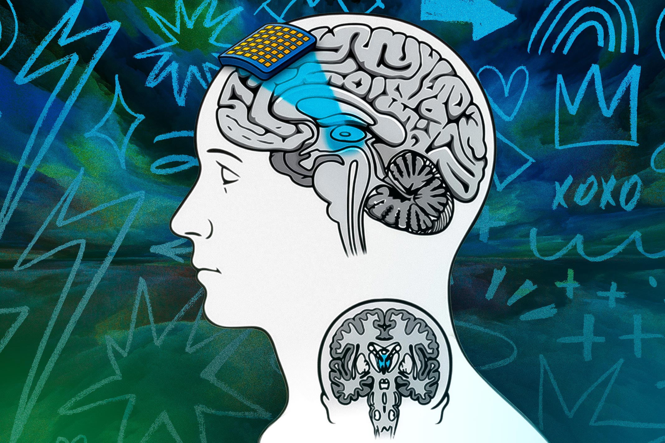 This Powerful New Brain Tool Could Tell Us How Consciousness Works