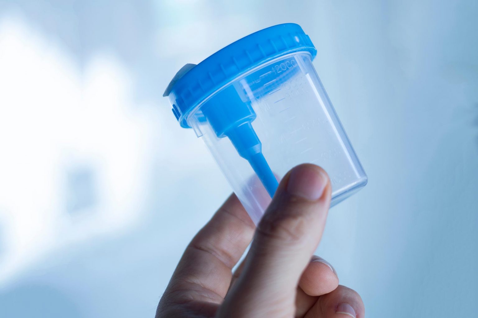 Simple Home Urine Test Could Revolutionize Diagnosis of Prostate Cancer