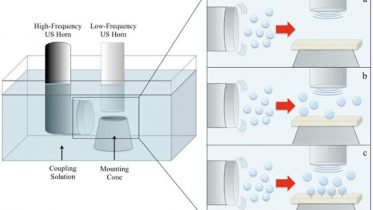 First Laser Ultrasound Images of Humans Produced Without Skin Contact