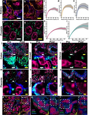 Unprecedented Views of Cell Interiors With New Expansion Microscopy ...
