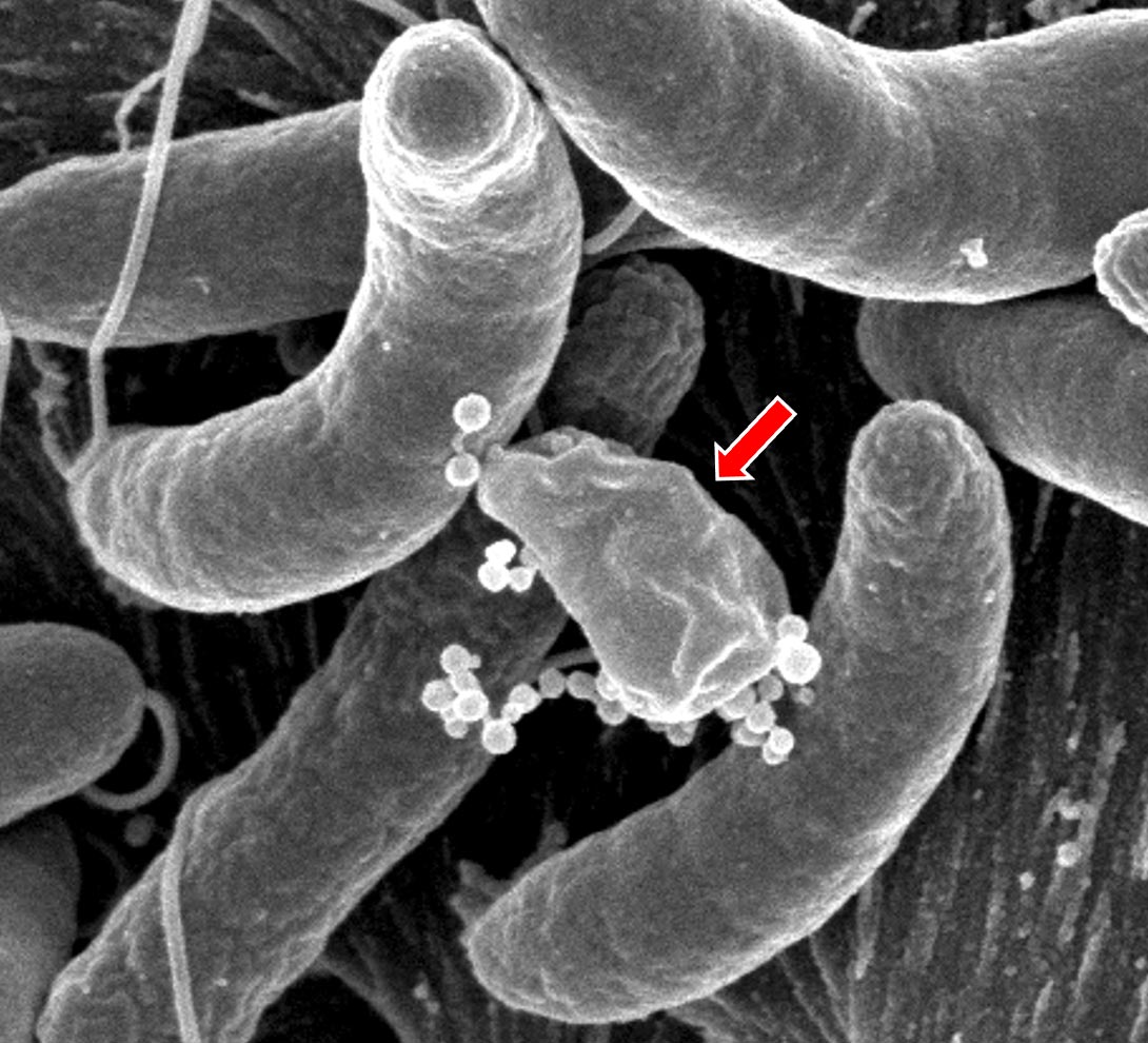 War in the Gut: How Microbes in the Human Gut Resist the Cholera Bacterium
