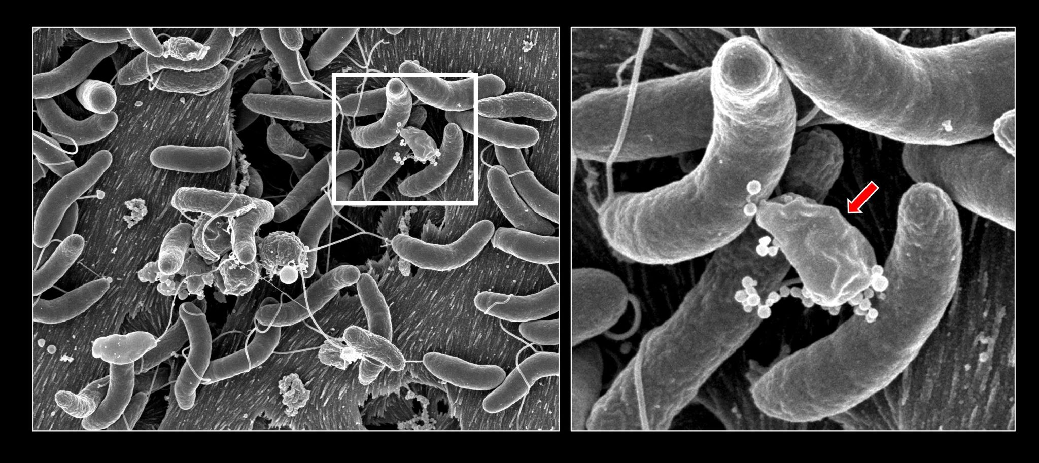 War in the Gut: How Microbes in the Human Gut Resist the Cholera Bacterium