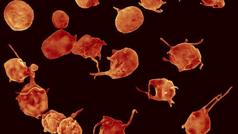 COVID-19 Research Reveals Additional Link Between Immune System and ...