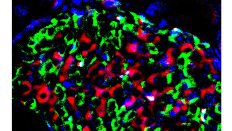 New Method Uses Vitamin D to Treat Diabetes and Protect β Cells