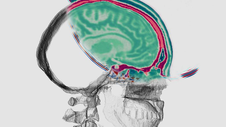 Combining Three Brain-Imaging Techniques Boosts Precision – Could Have ...