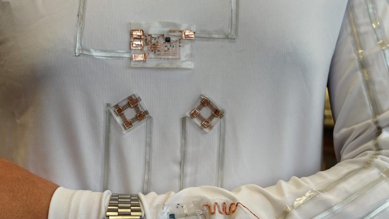 Compact Wearable “Lab on the Skin” Continuously Monitors Glucose ...