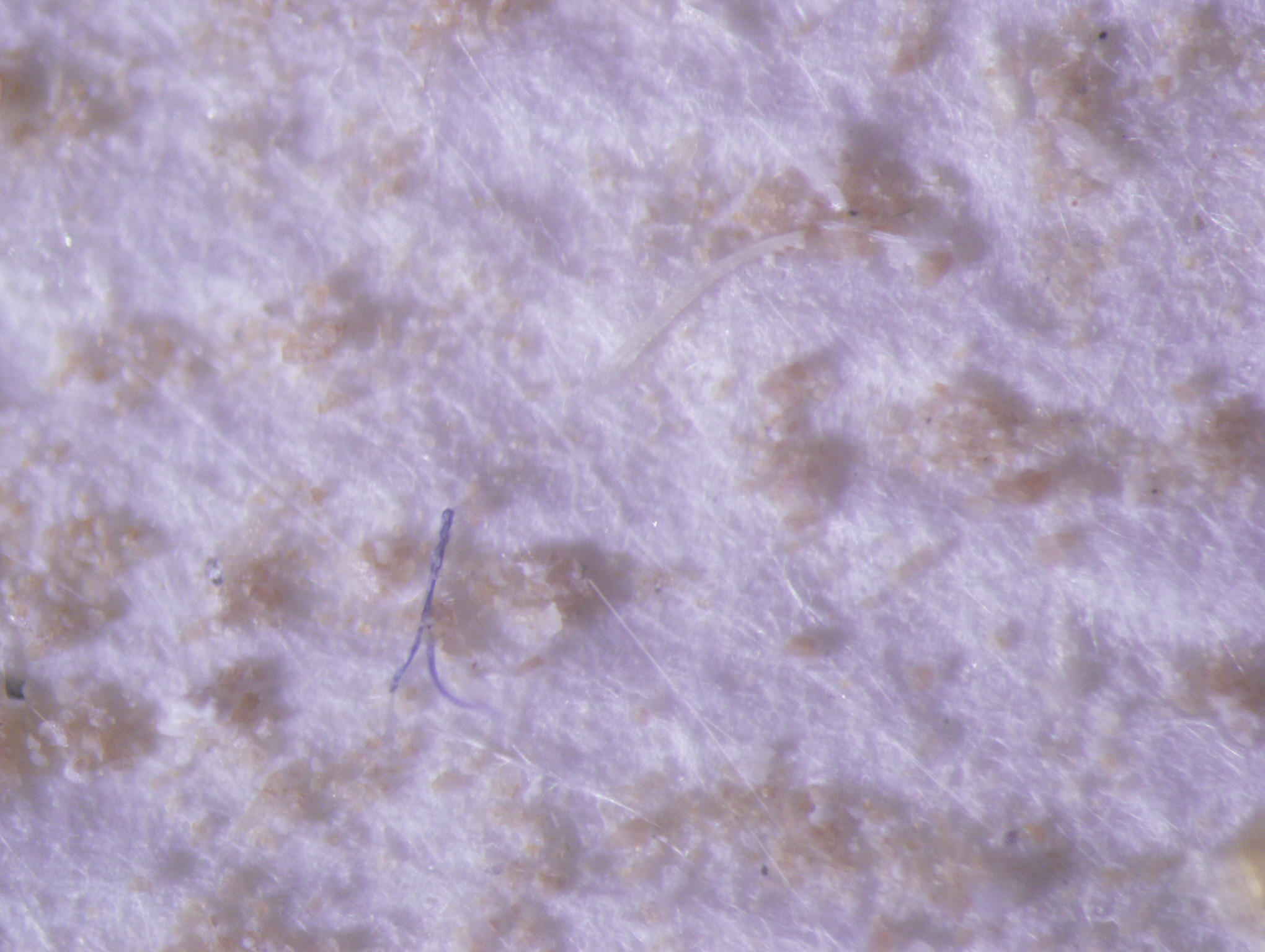 Ocean’s Silent Plastic Invasion: Marine Mammals Now Carry Microplastics ...