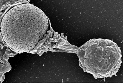 Squishy White Blood Cells Quickly Morph To Become Highly Stiff and ...