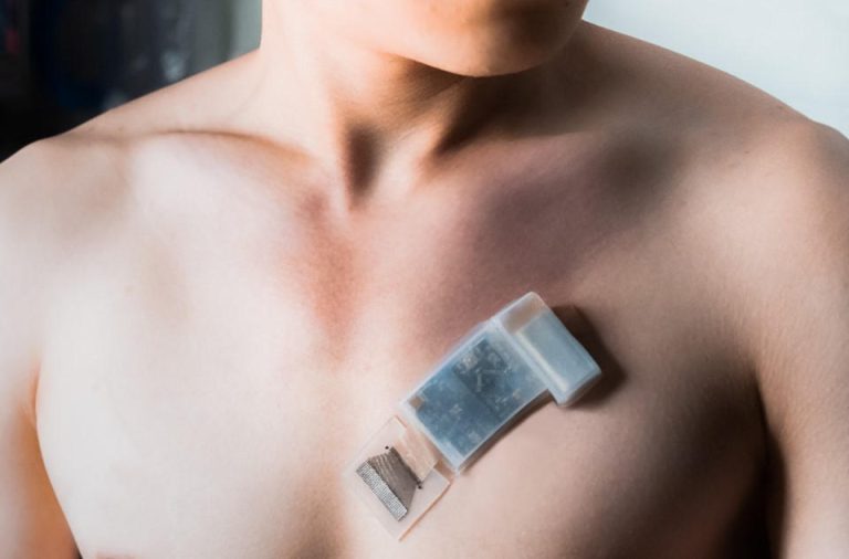Engineers Develop the First Fully Integrated Wearable Ultrasound System ...