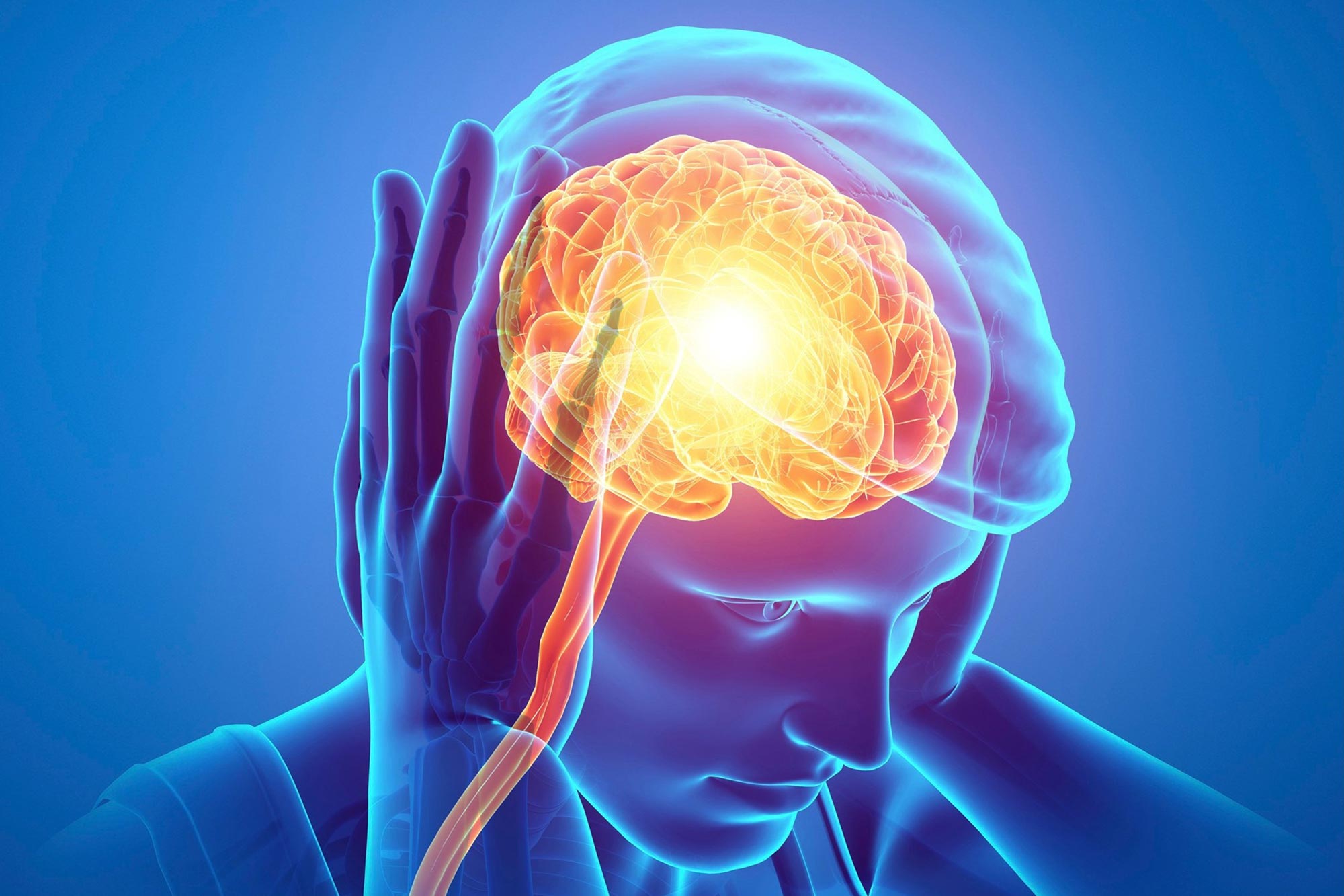 Why the Best Migraine Cure Might Already Be in Your Medicine Cabinet