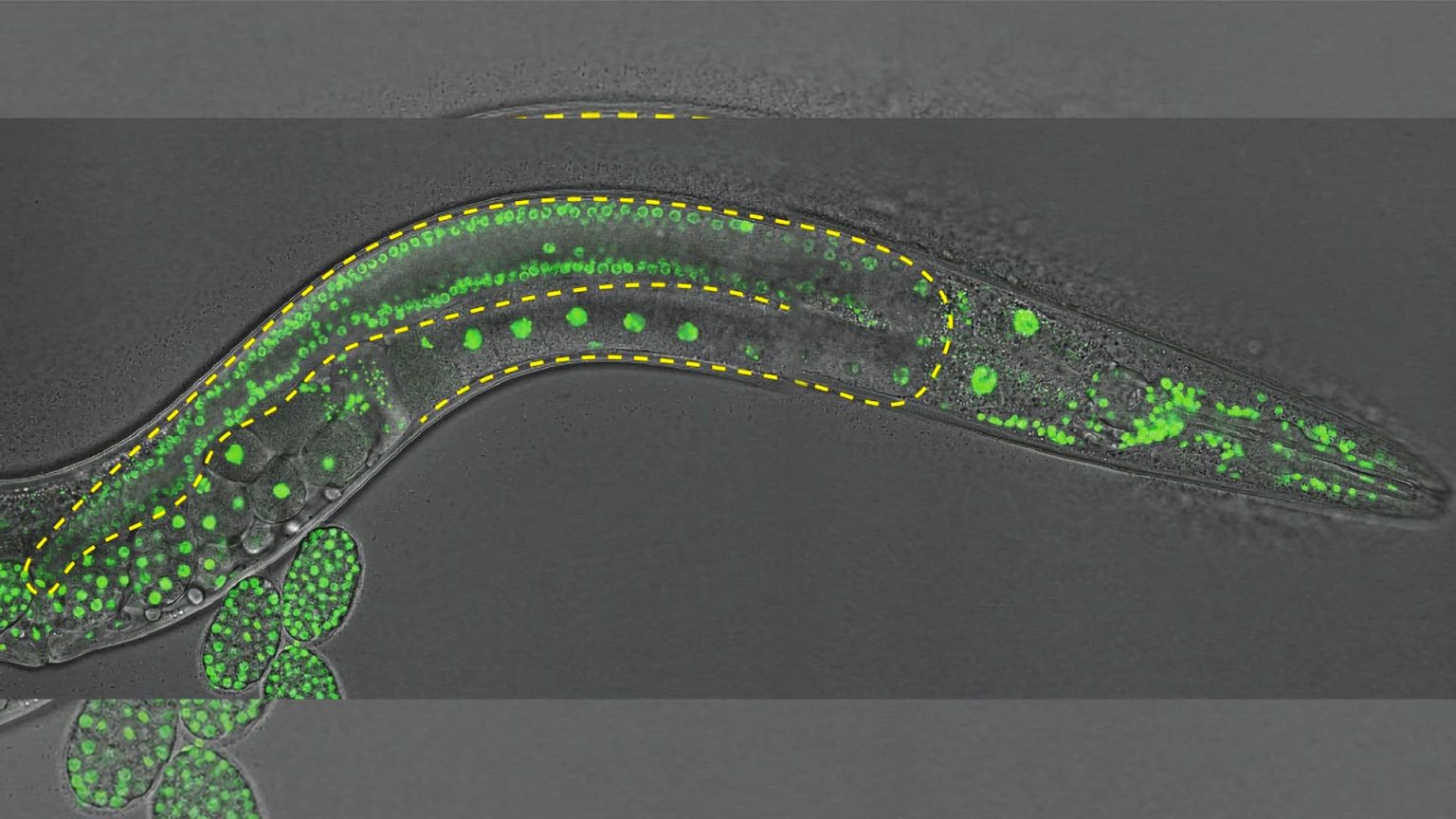 Worming Their Way Into the Secrets of Cell Differentiation – A ...