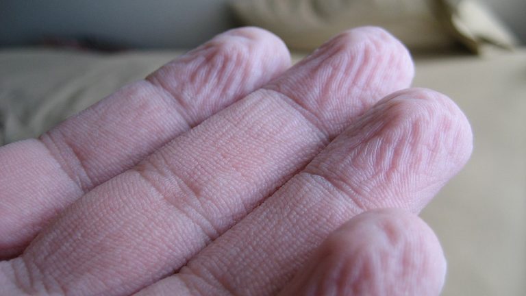 Your Fingers Wrinkle in the Same Pattern Every Time