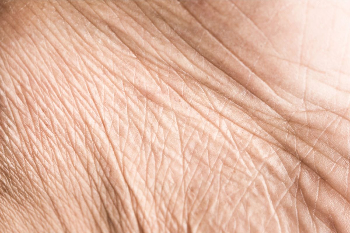 The Mystery of Human Wrinkles: Scientists Unveil Secret Mechanisms