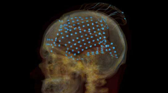 Neuroscientists Decode Correlation Between Sound and Brain Activity