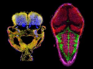 Key Process in Brain Development Identified