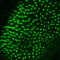 Scientists Identify a Unique Set of Proteins That Restore Hearing