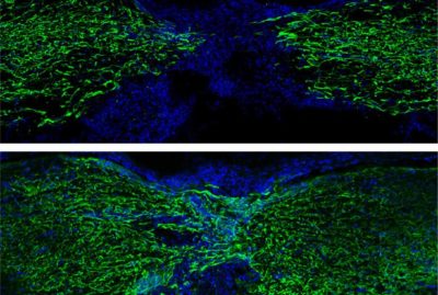 Astonishing Healing Powers of Zebrafish Could Revolutionize Spinal Cord ...