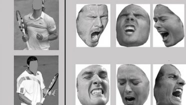 “Habsburg Jaw” Facial Deformity in Royal Dynasty Linked to Inbreeding