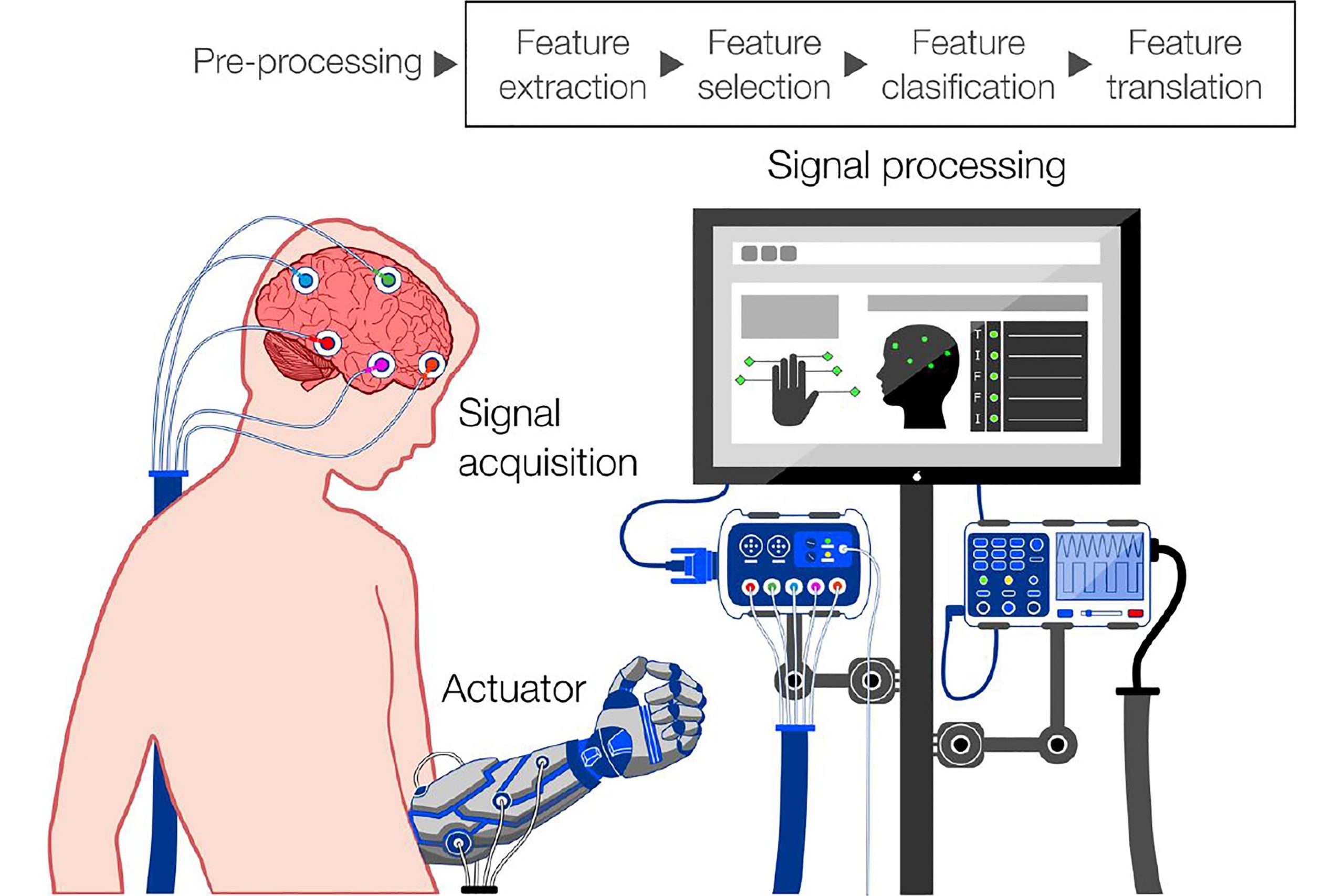Scientists Warn Of Bleak Cyborg Future From Brain Computer Interfaces