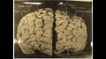 Photos of Einstein's Brain Show Unique Features