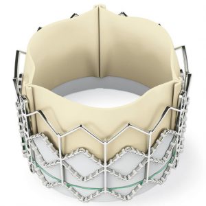 UCLA Cardiologists Complete Their First Transcatheter Aortic Valve ...