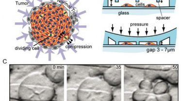 New Optical Microscope Improves Cancer Cell Detection